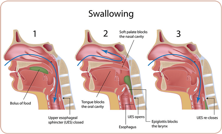 Swallowing issues and symptoms associated with PSP – CCF Coleen ...